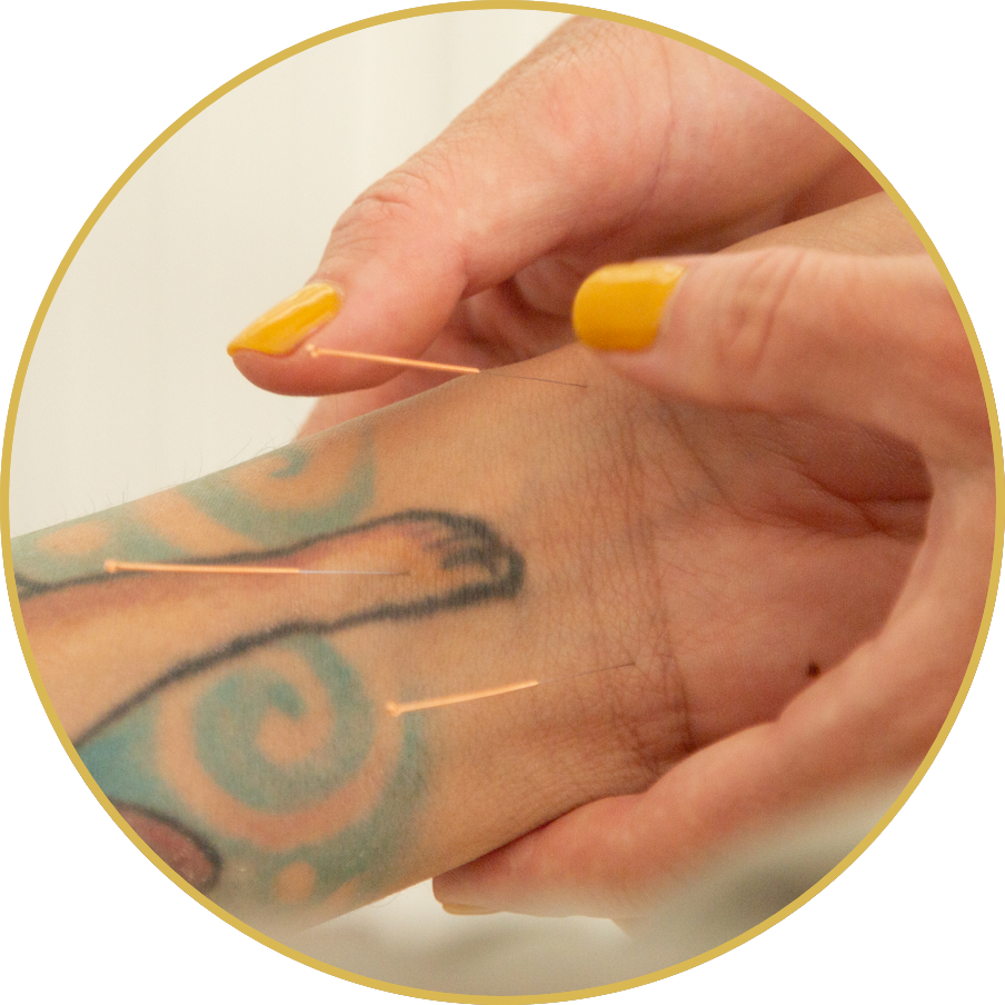 Home - PMA ACUPUNCTURE | PMA Acupuncture